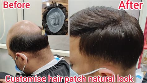 Polyfuse Hair Patch Customise Hair Fixing Delhi Best Quality Best Price Video Viral 7306761493