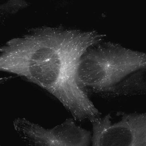 Cil26570 Homo Sapiens Epithelial Cell Retinal Pigment Epithelial