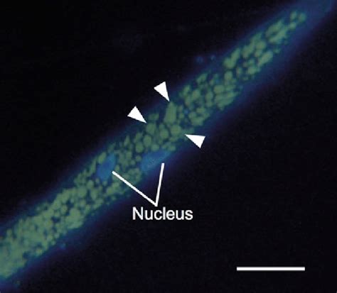 2 Polyphosphate Status In The Vacuoles Of Gigaspora Margarita Germ