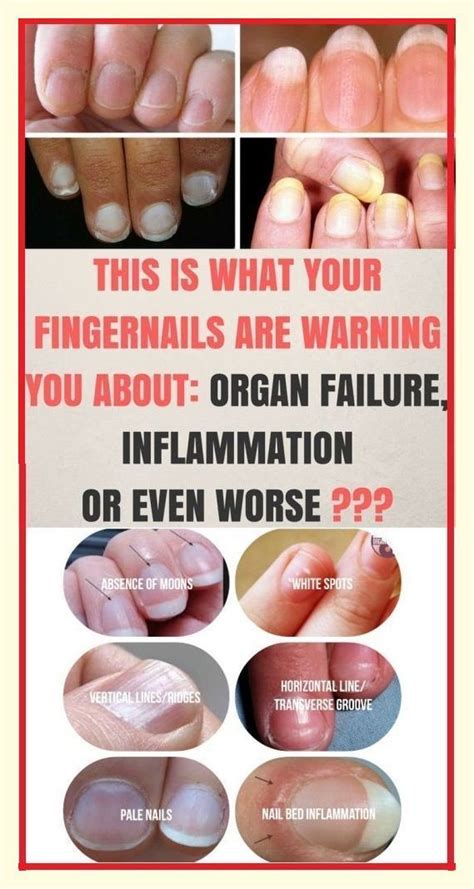 Fingernails Warning You Artofit