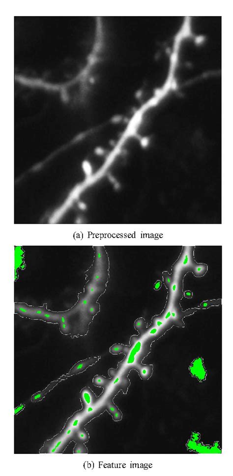 Figure 3 From A Tool For Automatic Dendritic Spine Detection And Analysis Part I Dendritic