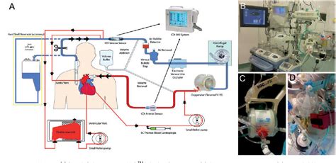 Figure 1 From Ultra Fast Track Minimally Invasive Aortic Valve