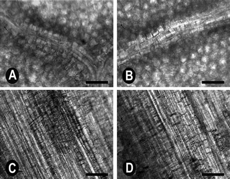 Calcium Oxalate Crystals In Plants