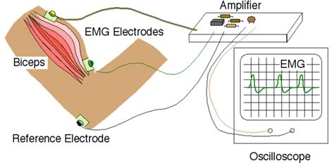 Working Principles And Applications Of Electromyography Emg Sensors