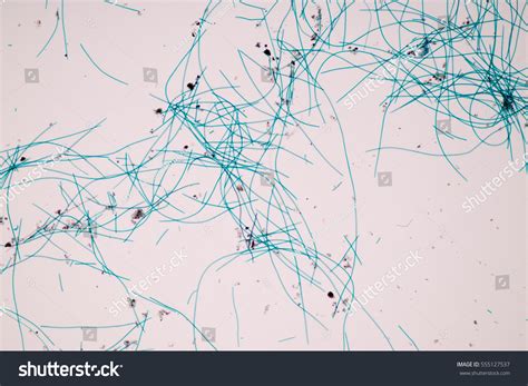 Oscillatoria Under A Microscope