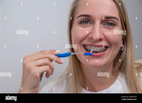 Cleaning Teeth With Braces Brush At Jerry Fifield Blog