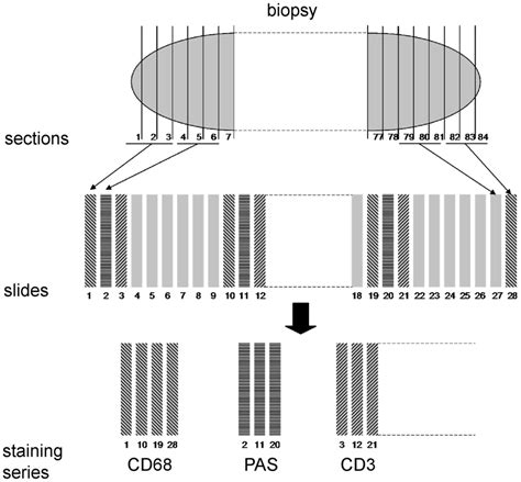 Schematic Sur Sampling Of The Sections Of A Biopsy After Exhaustive
