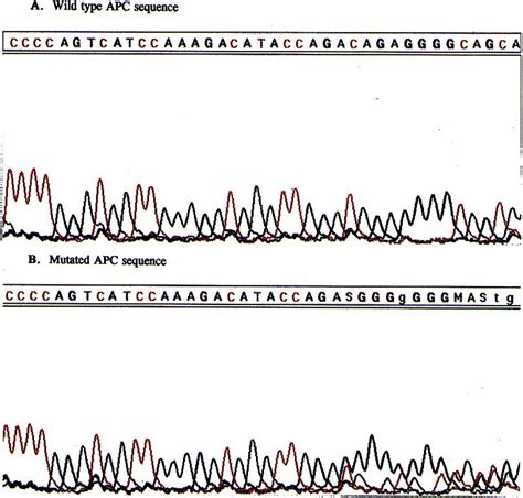 Sequence Analysis Of The Mutated Region In Exon 15 A Normal