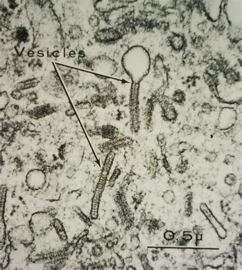 Langerhans Cell Histiocytosis Birbeck Granules This Elec Flickr
