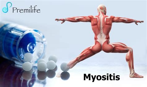 Myositis Premilife Homeopathic Remedies