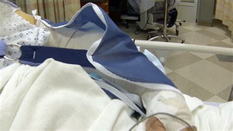 Surgery Recovery Man Arm In Bed And Sling Man In Hospital Recovery