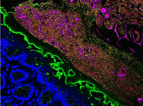 Princeton Scientists Explain How Diverse Species Coexist In Microbial Communities