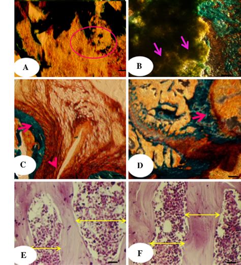 Disconnected Trabecular Tissue A Gel Layer Adhesion To The New Bone