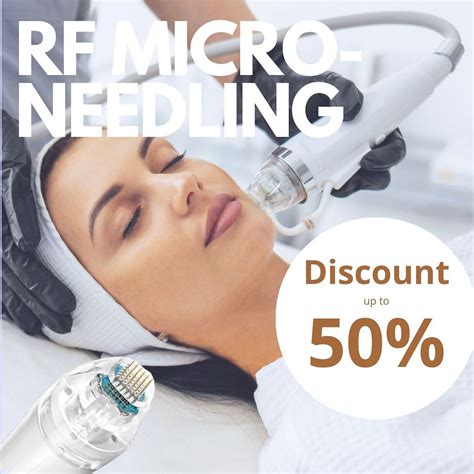 Fractional Rf Micro Needling 50 Off My Body Vibes