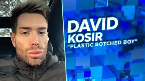 The More Plastic The More Fantastic David Kosir Spent 100000 To