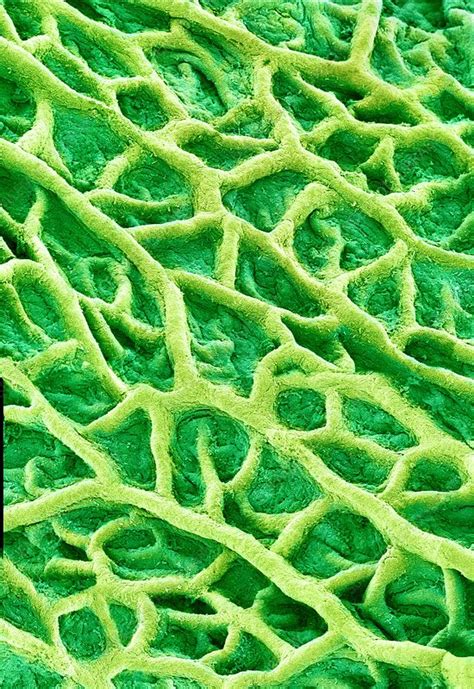 Gallbladder Surface Sem Stock Image C021 5231 Science Photo Library