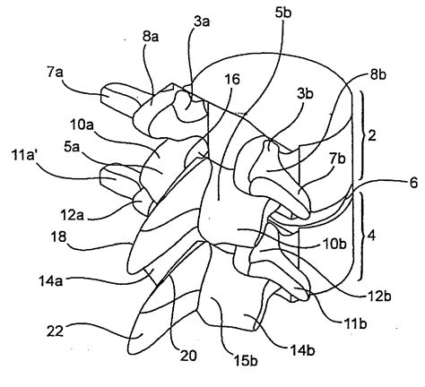 Bone Structures Patented Technology Retrieval Search Results Eureka