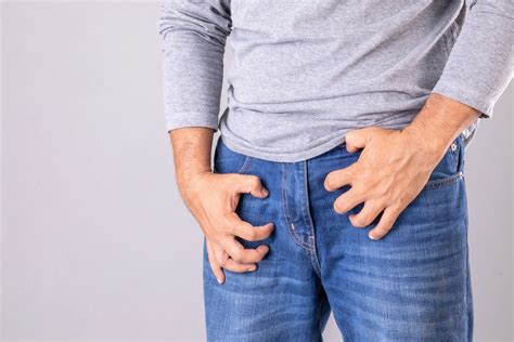 Jock Itch Tinea Cruris Symptoms Is It Contagious And How To Treat