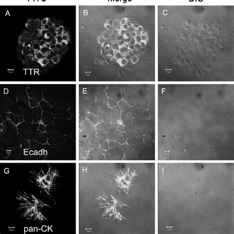 2 Morphology Of Choroid Plexus Epithelial Cells In Culture Primary