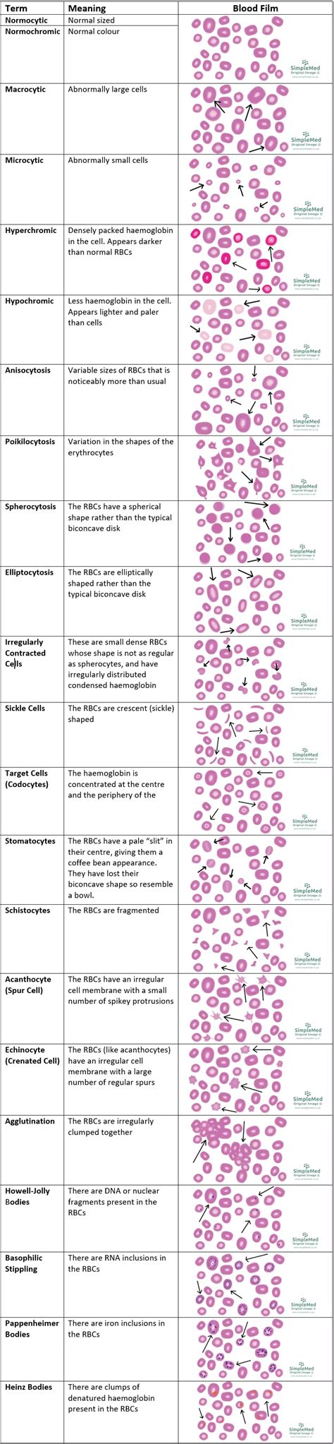 2 Full Blood Count Simplemed Learning Medicine Simplified