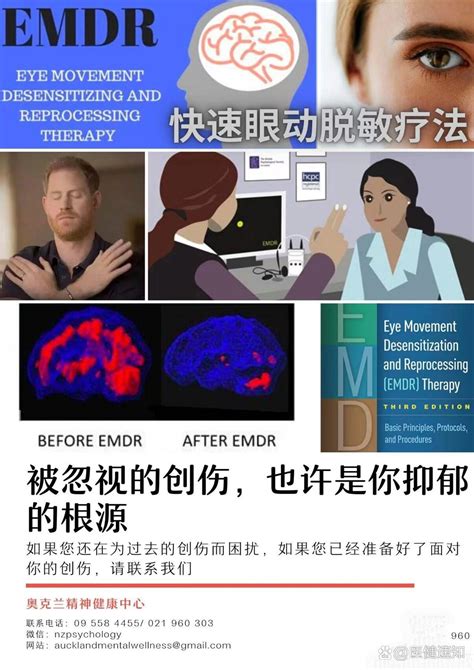 快速眼动脱敏疗法