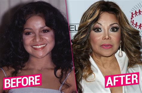 Lala Anthony Before And After Nose Job