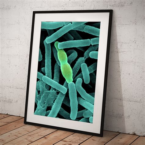 Bacillus Anthracis 20 Poster By Science Photo Library Science Photo Gallery