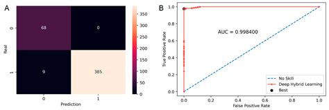 Deep Hybrid Learning Prediction Of Patient Specific Quality Assurance In Radiotherapy