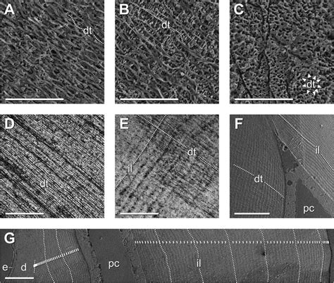 Dentine Microstructure Of The Teeth From Ihark Ut A Epoxy Infillings