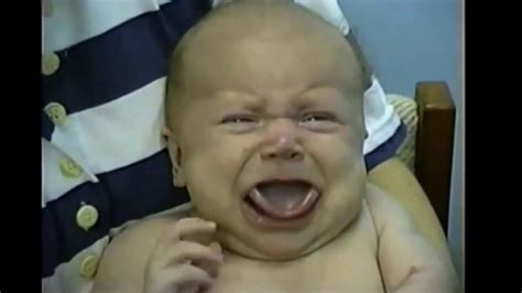 Macroglossia At Birth And Later Short Virtual Clinics Youtube