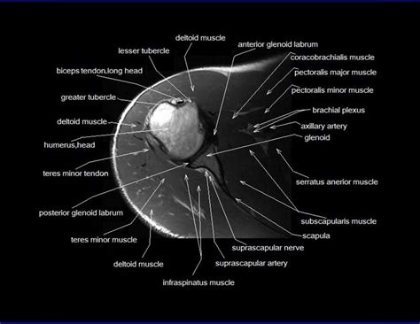 Deltoid Muscle Anatomy Mri