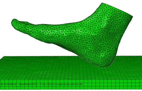 Gait Simulation Exploring Biomechanical Consequences Of Surgeries