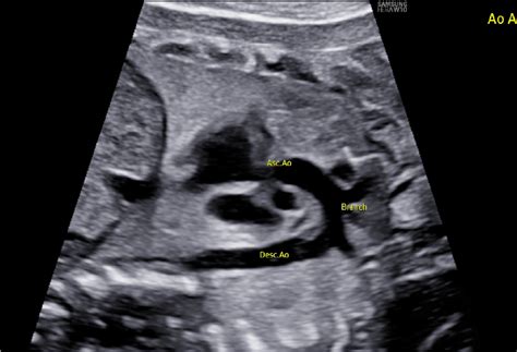 Samsung Hera W10 Elite Advmedical C A