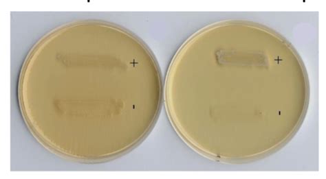 Selective And Differential Media Flashcards Quizlet