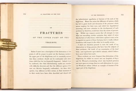 A Treatise On Dislocations And On Fractures Of The Joints By Cooper Sir Astley Paston Very
