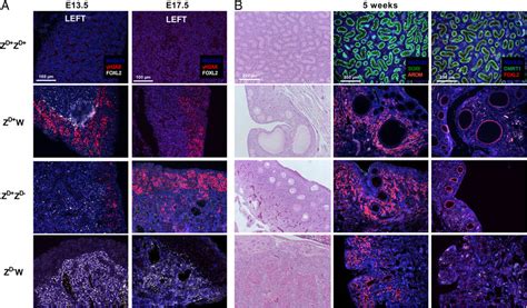 Effect Of Dmrt1 Loss On Follicular Development A Foxl2 And γh2ax Download Scientific Diagram