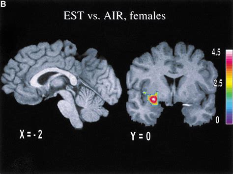 Smelling Of Odorous Sex Hormone Like Compounds Causes Sex