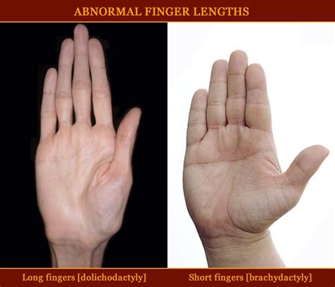 Finger Length Long Fingers Vs Short Fingers The Implications