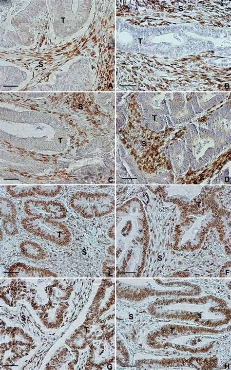 Differential Expression Of Lamins Ac In Colorectal Cancer 4 Mm Download Scientific Diagram