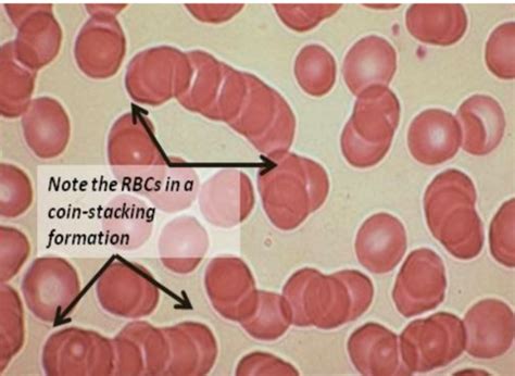Hema Lec 6 Page 1 2 Rbc Structure And Function Hemoglobin Synthesis