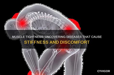 Muscle Tightness Uncovering Diseases That Cause Stiffness And