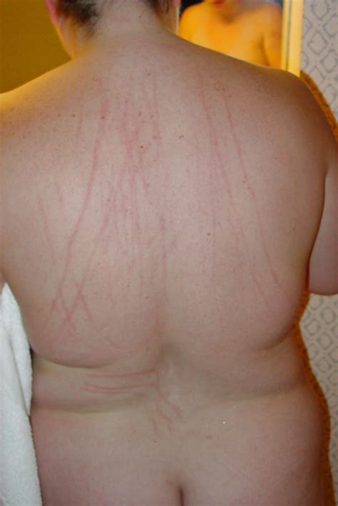 Claw Marks Porn Pictures Xxx Photos Sex Images 1724023 Pictoa