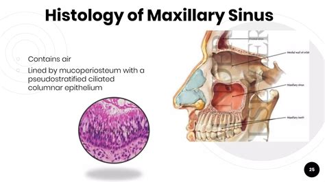 Maxillary Sinus Imaging Pptx