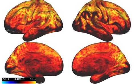 Tsnr Maps Overview — Neurodocs 011 Documentation