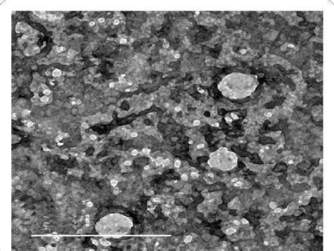 Transmission Electron Micrograph Of Isolated Exosomes Using