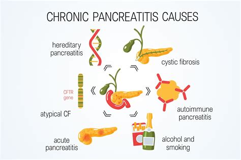 Enzyme Therapy For Chronic Pancreatitis At Kevin Blankenship Blog