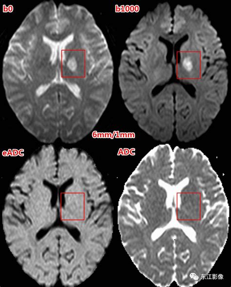 Mri的五大基本序列序列序列图第2页大山谷图库