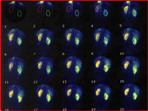Medical Uses Of Ionizing Radiation Anppt