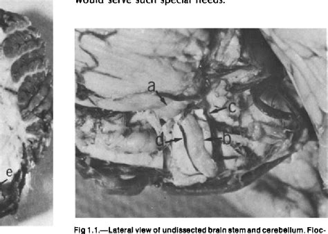 Figure 1 From The Cochlear Nuclei Revisited Semantic Scholar