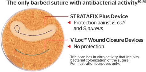 Stratafix™ Suture Knotless Suture Ethicon